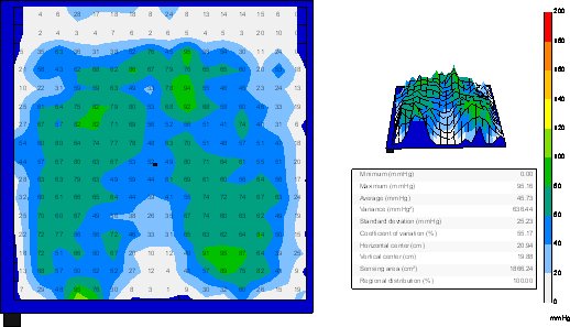 Pressure Mapping - Salisbury NHS Foundation Trust Department of Medical ...