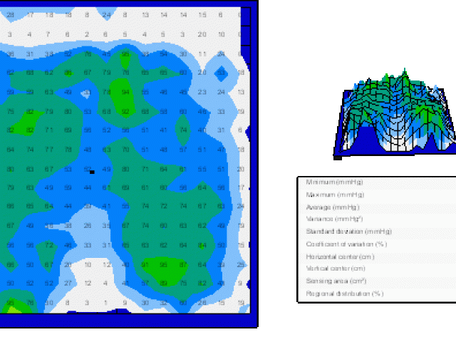 Pressure Mapping - Salisbury NHS Foundation Trust Department of Medical ...